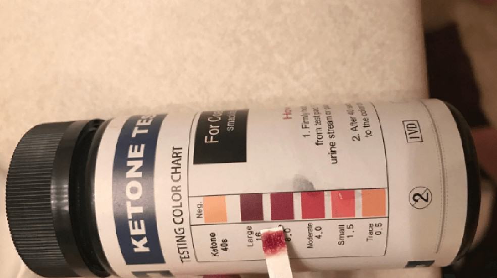 Smackfat Ketone Strips: Urine Ketone Testing Strips for Keto Dieters ...